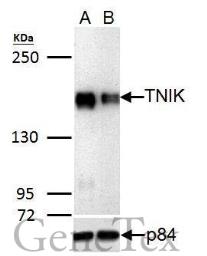 TNIK抗体 (GTX13141) | GeneTex中国官方网站