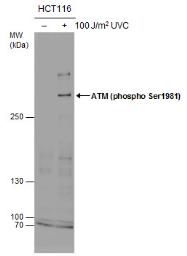 ATM (phospho Ser1981)抗体 (GTX132146) | GeneTex中国官方网站
