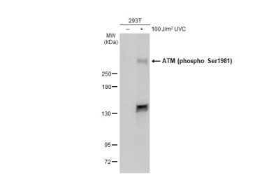 ATM (phospho Ser1981)抗体 (GTX132146) | GeneTex中国官方网站