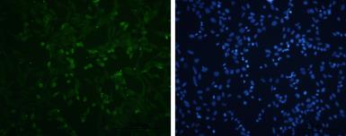 Enterovirus 71 VP3抗体 (GTX132341) | GeneTex中国官方网站