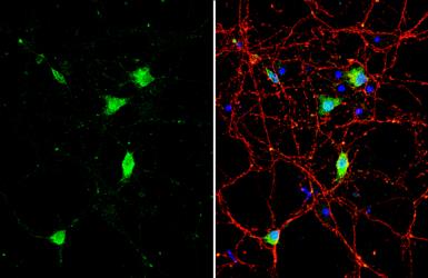 BDNF抗体 (GTX132621) | GeneTex中国官方网站