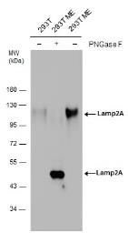 LAMP2A抗体 (GTX132655) | GeneTex中国官方网站