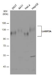 LAMP2A抗体 (GTX132655) | GeneTex中国官方网站