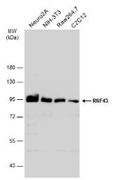 RNF43抗体 (GTX132671) | GeneTex中国官方网站