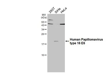 Human Papillomavirus type 16 E6抗体 (GTX132686) | GeneTex中文官方网站