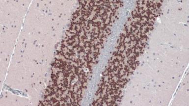 NeuN抗体 (GTX132974) | GeneTex中国官方网站