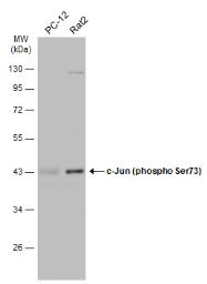 c-Jun (phospho Ser73)抗体 (GTX133873) | GeneTex中国官方网站