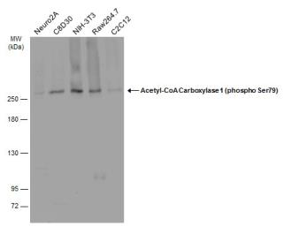 Acetyl-CoA Carboxylase 1 (phospho Ser79)抗体 (GTX133974) | GeneTex中国官方网站