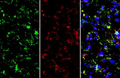 TMEM119抗体 (GTX134087) | GeneTex中国官方网站