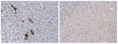 beta Amyloid (1-42)抗体 – Conformation Specific (GTX134510) | GeneTex中国官方网站