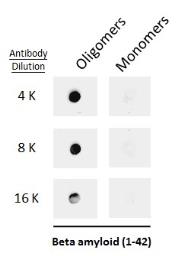 beta Amyloid (1-42)抗体 – Conformation Specific (GTX134510) | GeneTex中国官方网站
