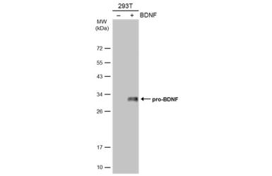 BDNF抗体 (GTX134514) | GeneTex中国官方网站