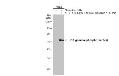 IKK gamma (phospho Ser376)抗体 (GTX134550) | GeneTex中国官方网站