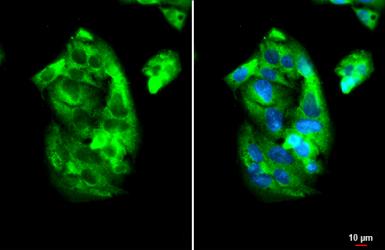 IGF2BP2抗体 (GTX134817) | GeneTex中国官方网站