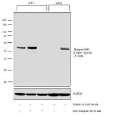 SHC1 (phospho Tyr239/Tyr240)抗体 (GTX24890) | GeneTex中国官方网站