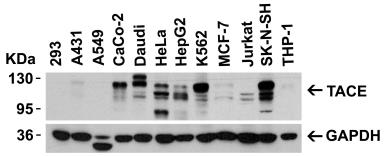 ADAM17抗体 (GTX31632) | GeneTex中国官方网站