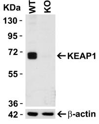 KEAP1抗体 (GTX31864) | GeneTex中国官方网站