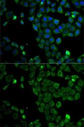 MSR1抗体 (GTX32729) | GeneTex中国官方网站