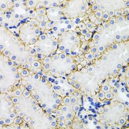 SLC1A4抗体 (GTX32877) | GeneTex中国官方网站