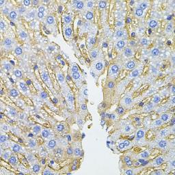 SLC1A4抗体 (GTX32877) | GeneTex中国官方网站