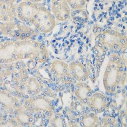 C3 / C3c抗体 (GTX33050) | GeneTex中国官方网站