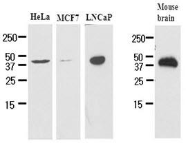 TREM2抗体 [2B5] (GTX50036) | GeneTex中国官方网站