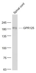 GPR125抗体 (GTX51219) | GeneTex中国官方网站