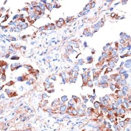 TIM-3抗体 (GTX54117) | GeneTex中国官方网站