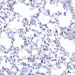 SFTPC抗体 (GTX54694) | GeneTex中国官方网站