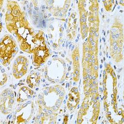 OPG抗体 (GTX55734) | GeneTex中国官方网站