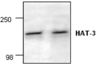 KAT6A抗体 (GTX59754) | GeneTex中国官方网站