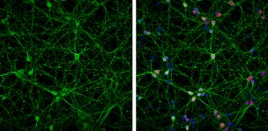 beta Tubulin 3/ Tuj1抗体 [GT886] (GTX631830) | GeneTex中国官方网站