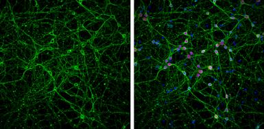 beta Tubulin 3/ Tuj1抗体 [GT1338] (GTX631831) | GeneTex中国官方网站