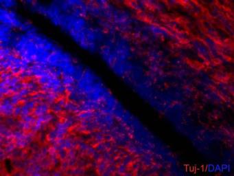 beta Tubulin 3/ Tuj1抗体 [GT11710] (GTX631836) | GeneTex中国官方网站