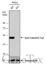 beta Tubulin 3/ Tuj1抗体 [GT11710] (GTX631836) | GeneTex中国官方网站