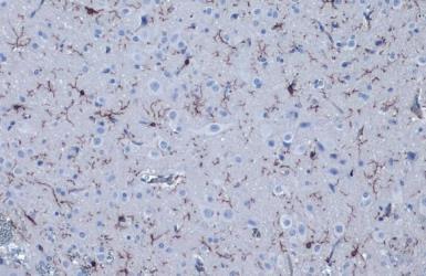 Iba1抗体 [HL22-MS] (GTX635399) | GeneTex中国官方网站