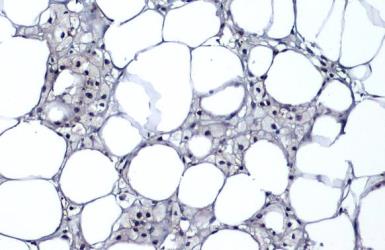 CDKN2A / p16INK4a抗体 [GT1249] (GTX635638) | GeneTex中国官方网站