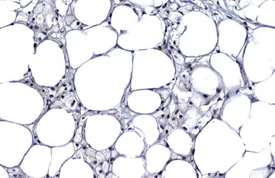 CDKN2A / p16INK4a抗体 [GT888] (GTX635639) | GeneTex中文官方网站