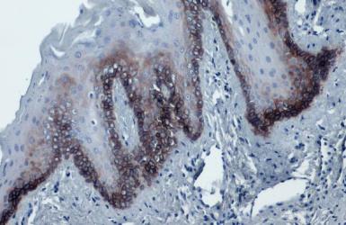 COL17A1抗体 [GT1055] (GTX64247) | GeneTex中国官方网站