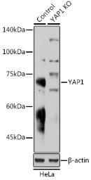 YAP1抗体 (GTX64337) | GeneTex中国官方网站