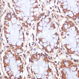 CPT1B抗体 (GTX64535) | GeneTex中国官方网站