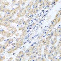 ITPKB抗体 (GTX65942) | GeneTex中国官方网站