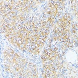 SLC7A2抗体 (GTX66268) | GeneTex中国官方网站