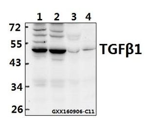 TGF beta 1抗体 (GTX66628) | GeneTex中国官方网站
