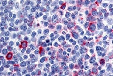 CCR8抗体 (GTX78049) | GeneTex中国官方网站