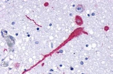 CCR7抗体 (GTX78157) | GeneTex中国官方网站