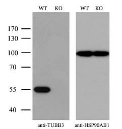 beta Tubulin 3/ Tuj1抗体 [5H2] (GTX83460) | GeneTex中国官方网站