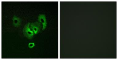 STEAP2抗体 (GTX87297) | GeneTex中国官方网站