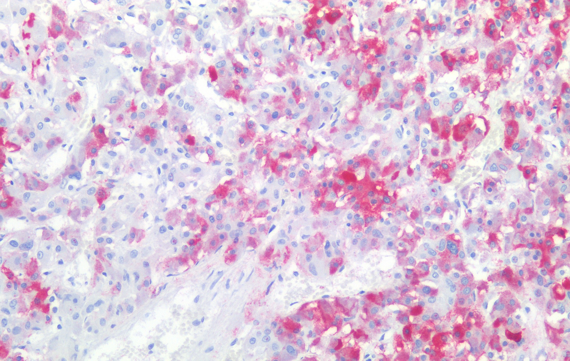 CD57 antibody [TB01]价格,详情介绍-960化工网 – 960化工网