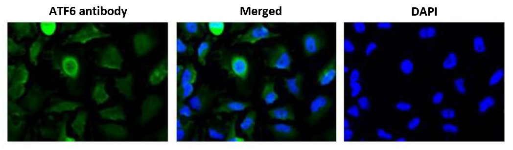 ATF6抗体 [1-7] (GTX00687) | GeneTex中国官方网站